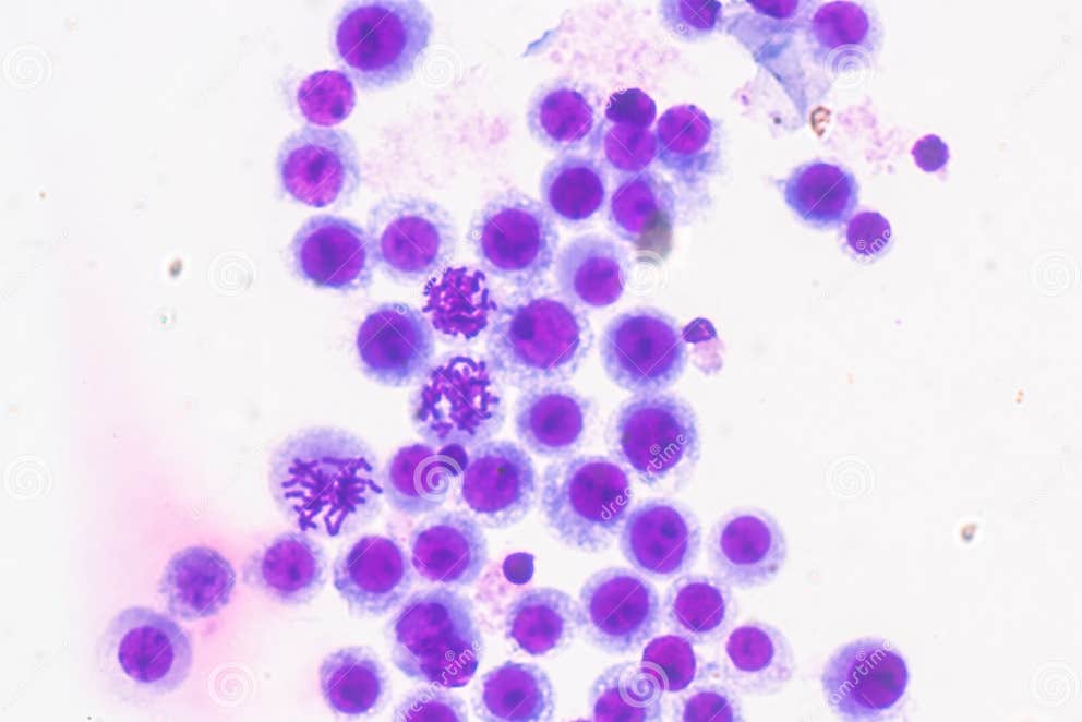 Chromosomes Human Under the Microscope. Stock Photo - Image of ...