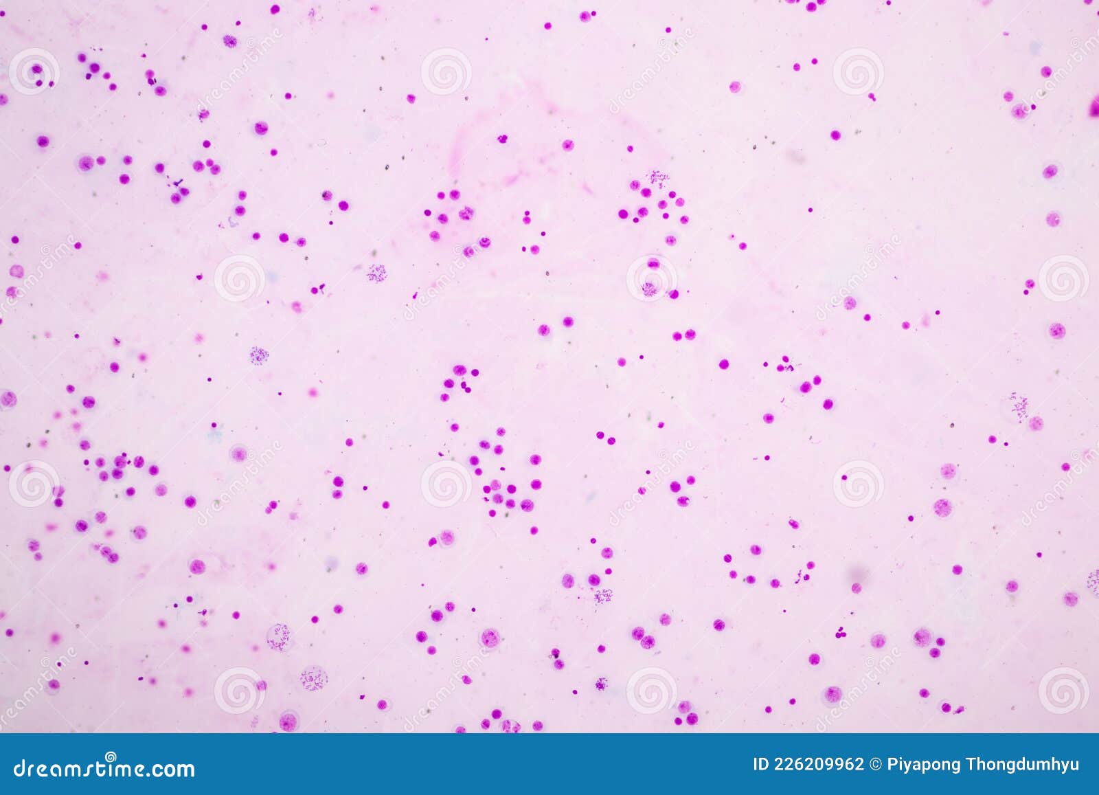 Chromosomes Human Under the Microscope. Stock Photo - Image of ...