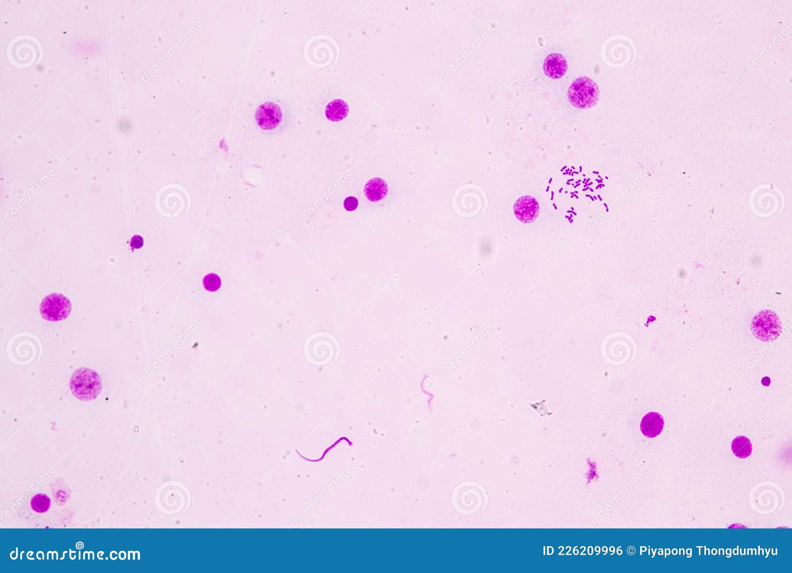 Chromosomes Human Under the Microscope. Stock Photo - Image of ...