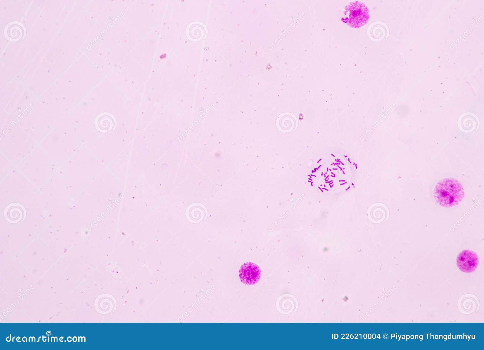 Chromosomes Human Under the Microscope. Stock Photo - Image of ...