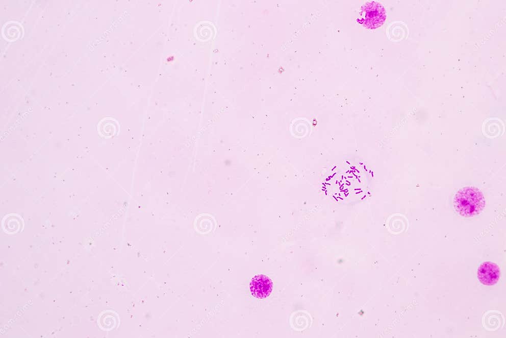 Chromosomes Human Under the Microscope. Stock Photo - Image of ...