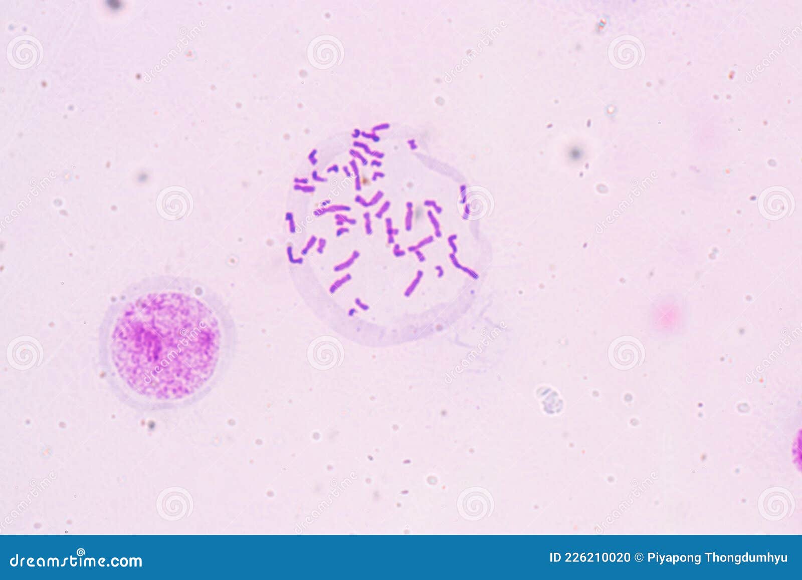 Chromosomes Human Under the Microscope. Stock Photo - Image of cloning ...