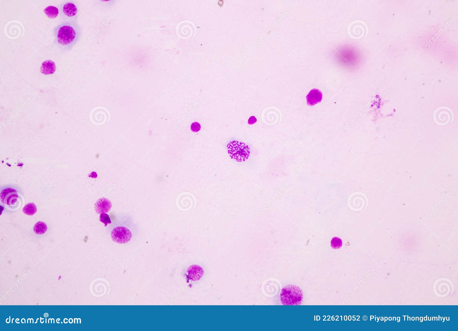Chromosomes Human Under the Microscope. Stock Photo - Image of ...