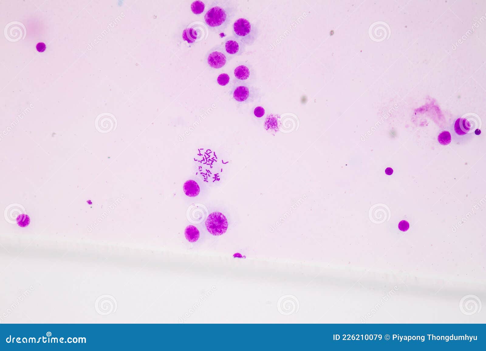 Chromosomes Human Under the Microscope. Stock Image - Image of germ ...
