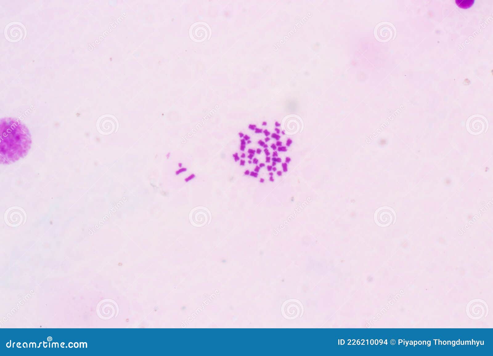 Chromosomes Human Under the Microscope. Stock Photo - Image of gene ...