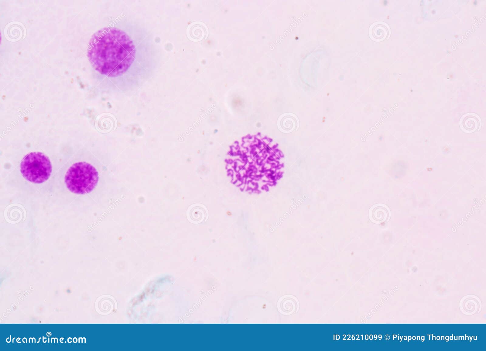 Chromosomes Human Under the Microscope. Stock Image - Image of ...