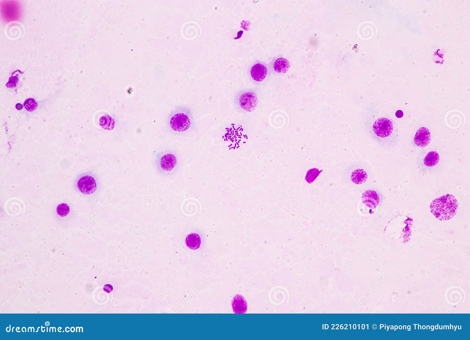 Chromosomes Human Under the Microscope. Stock Image - Image of genome ...