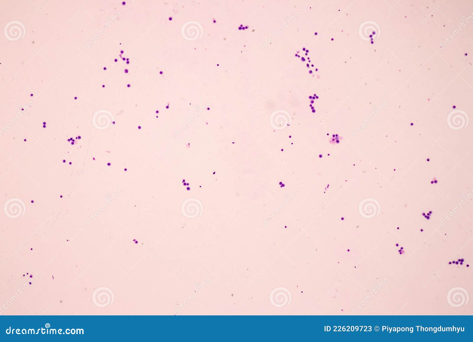 Chromosomes Human Under the Microscope. Stock Image - Image of cell ...