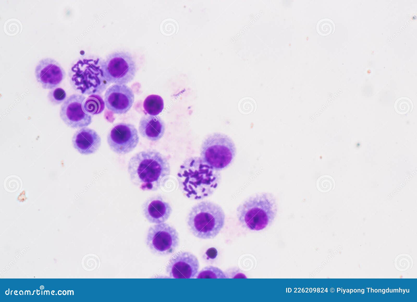 Chromosomes Human Under the Microscope. Stock Photo - Image of genome ...