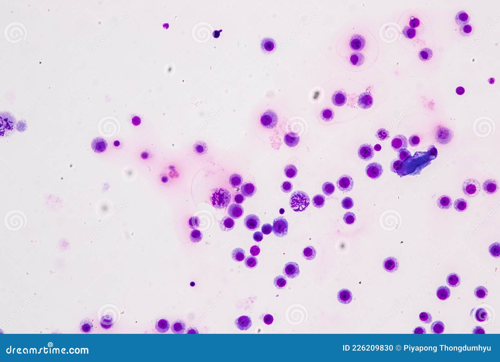 Chromosomes Human Under the Microscope. Stock Photo - Image of ...