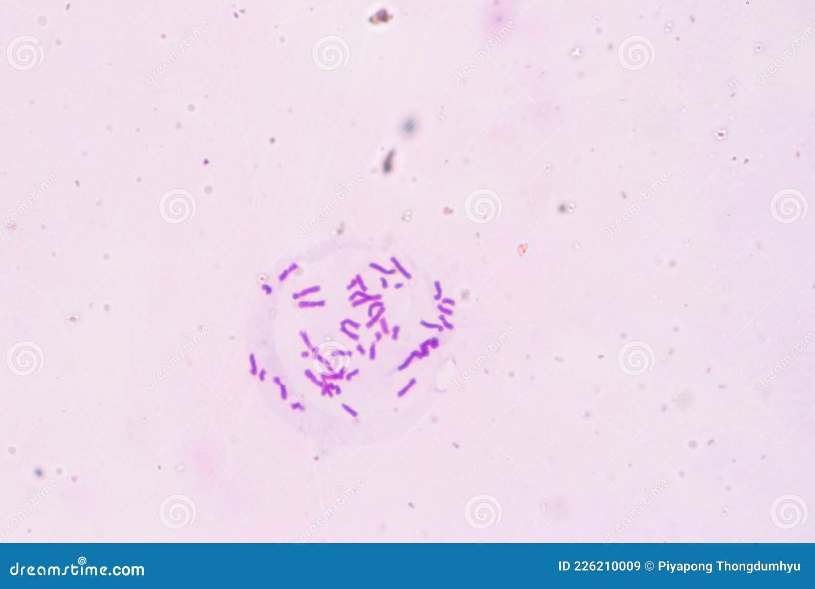 Chromosomes Human Under the Microscope. Stock Image - Image of ...