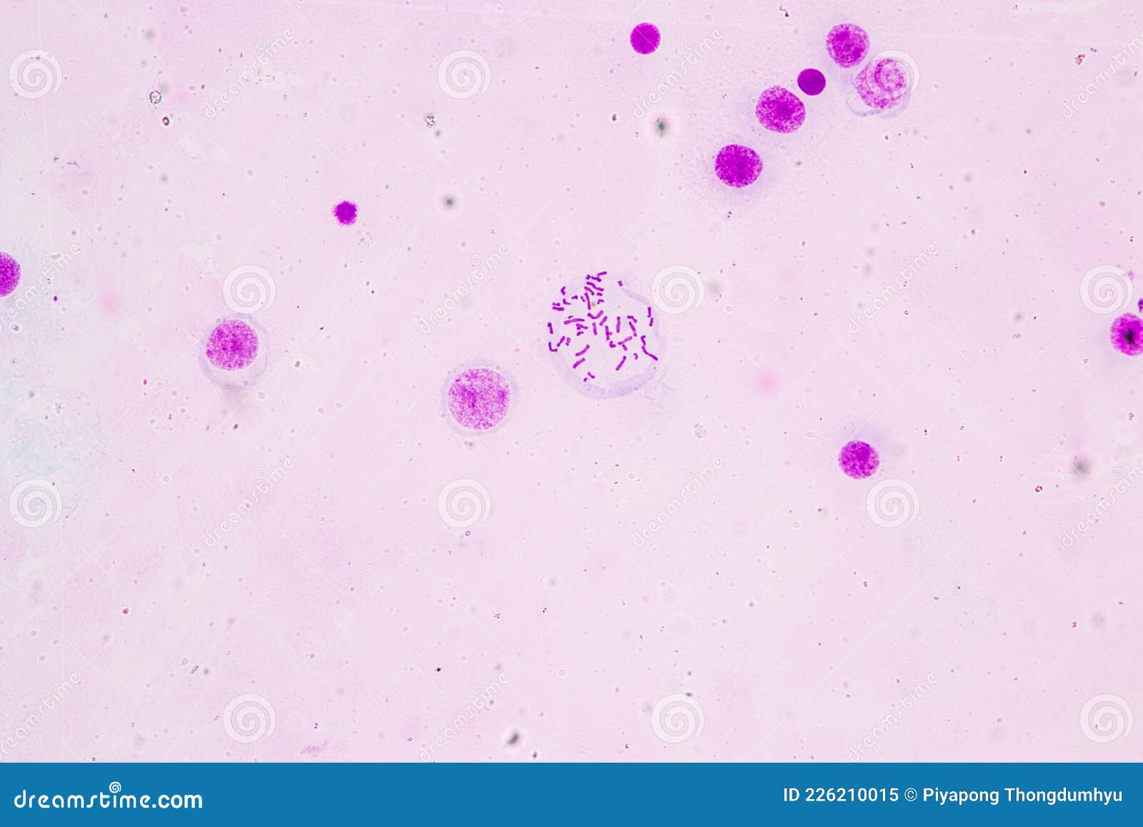 Chromosomes Human Under the Microscope. Stock Image - Image of ...