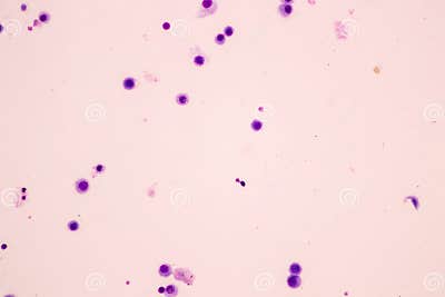 Chromosomes Human Under the Microscope. Stock Photo - Image of ...