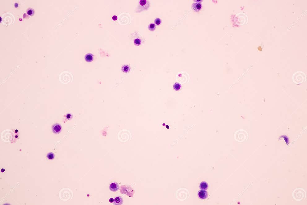 Chromosomes Human Under the Microscope. Stock Photo - Image of ...