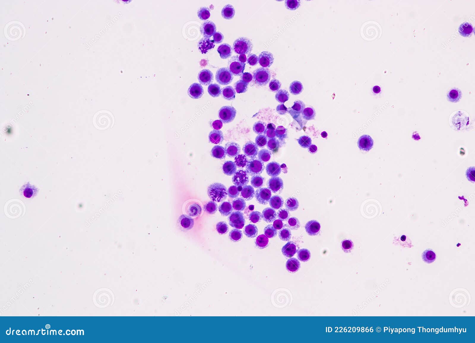 Chromosomes Human Under the Microscope. Stock Photo - Image of ...