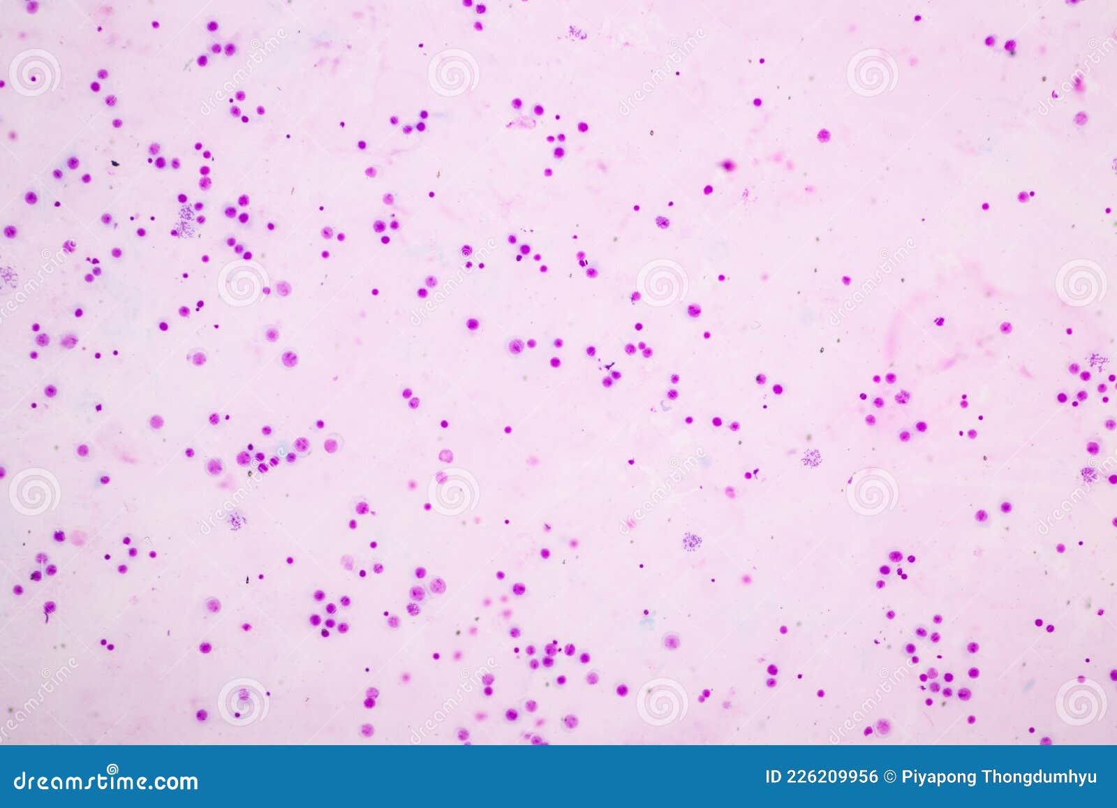 Chromosomes Human Under the Microscope. Stock Photo - Image of ...