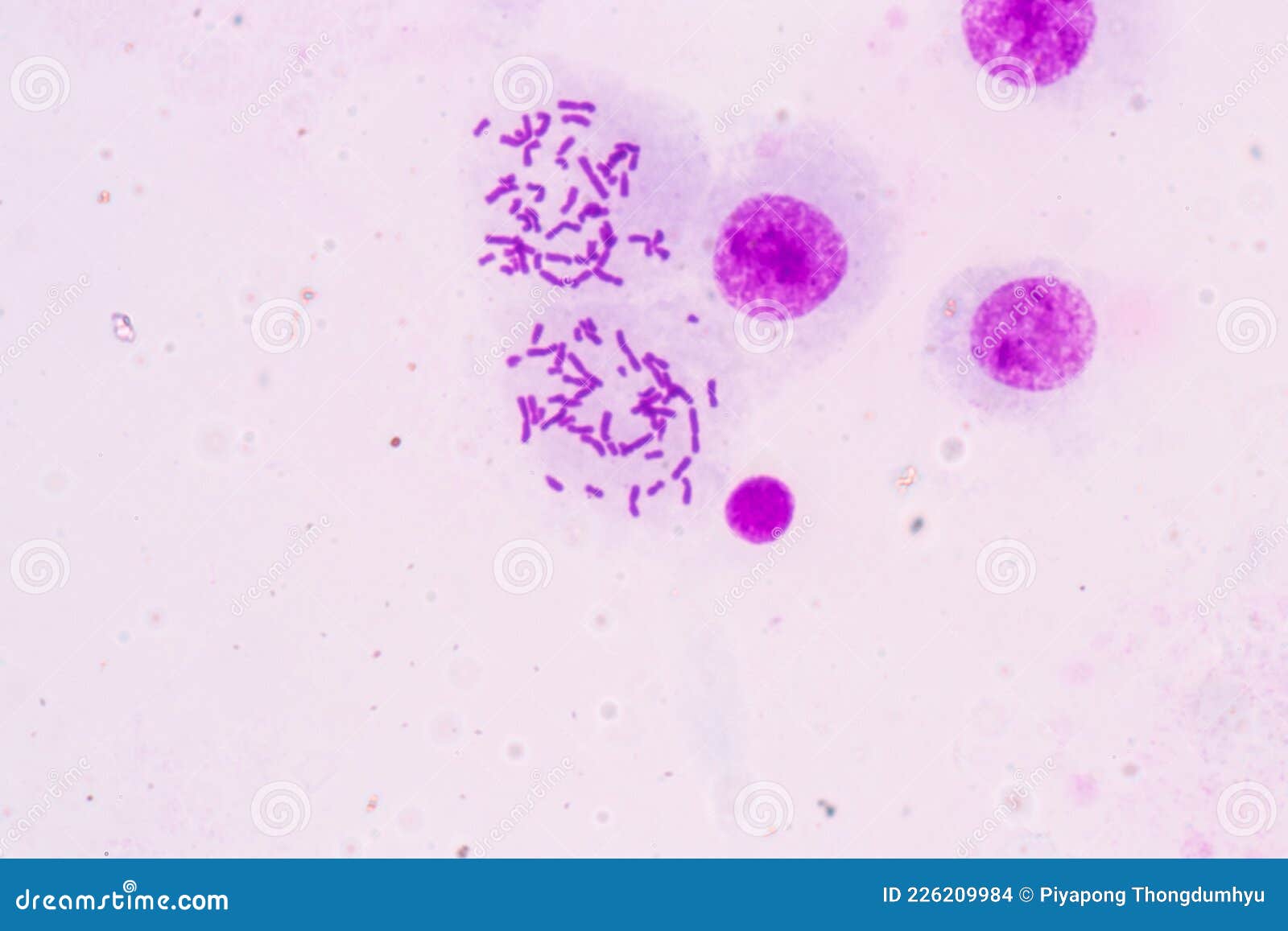 Chromosomes Human Under the Microscope. Stock Photo - Image of genetic ...