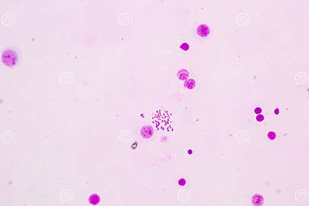 Chromosomes Human Under the Microscope. Stock Photo - Image of germ ...