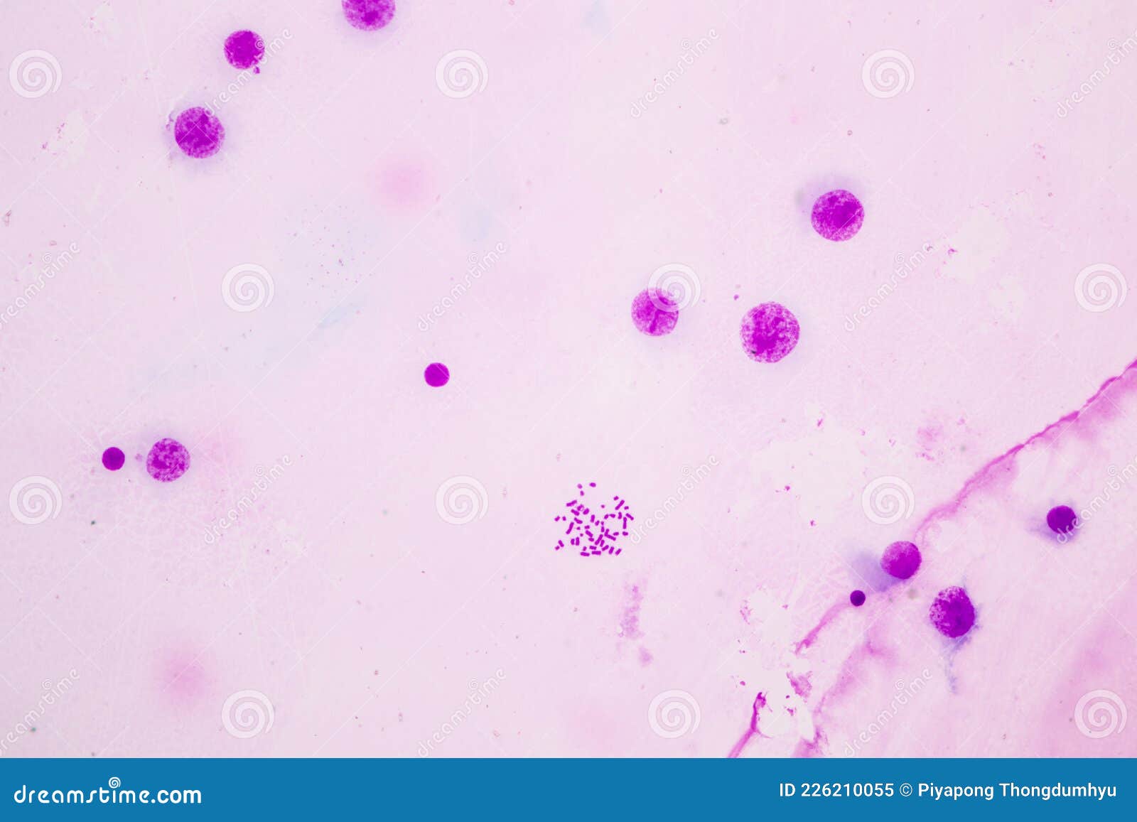 Chromosomes Human Under the Microscope. Stock Image - Image of ...