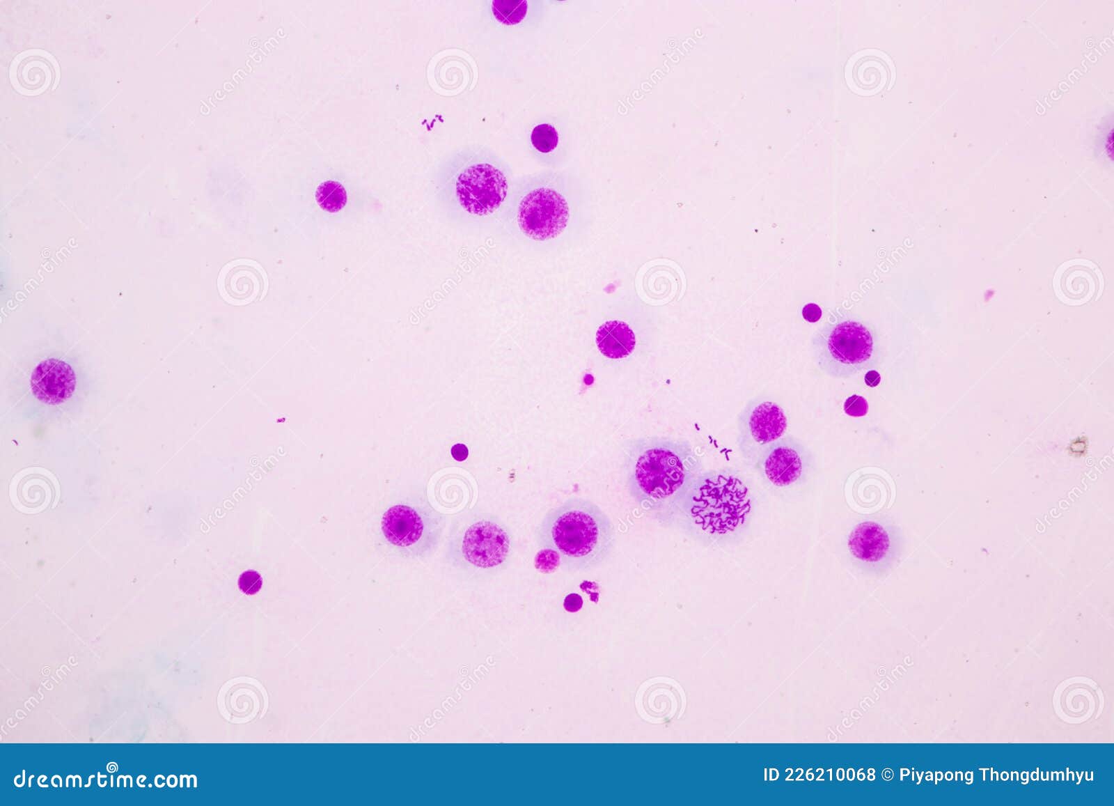Chromosomes Human Under the Microscope. Stock Photo - Image of human ...