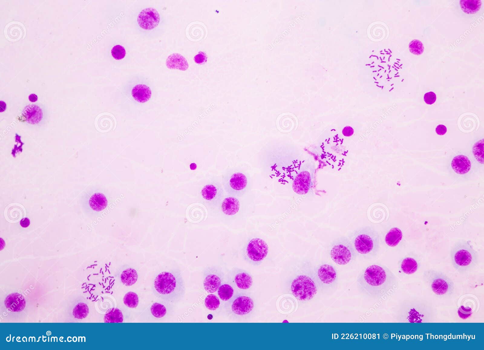 Chromosomes Human Under the Microscope. Stock Image - Image of ...