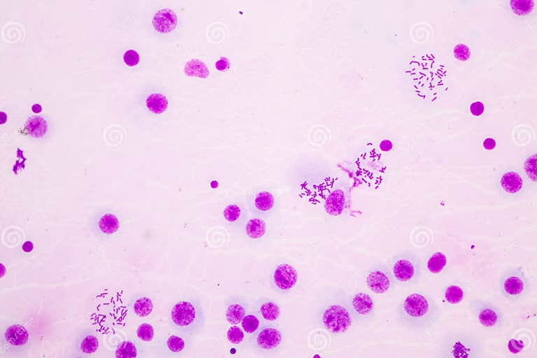 Chromosomes Human Under the Microscope. Stock Image - Image of ...