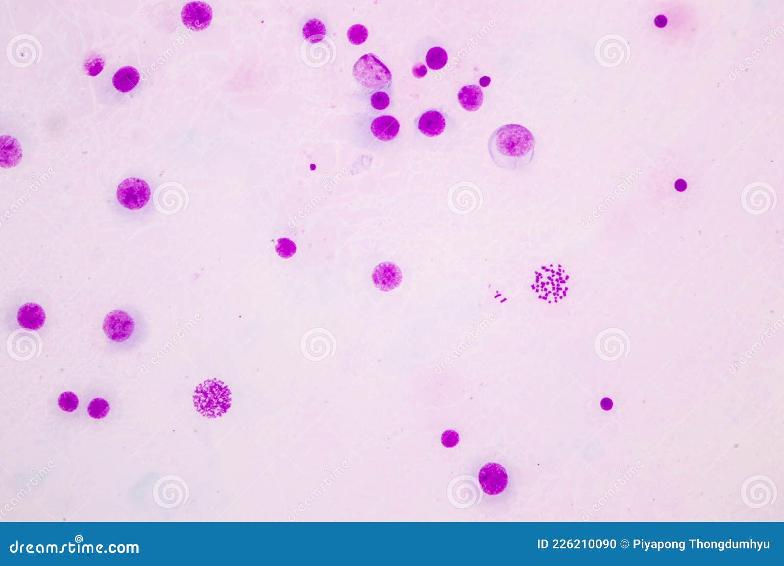 Chromosomes Human Under the Microscope. Stock Photo - Image of concept ...
