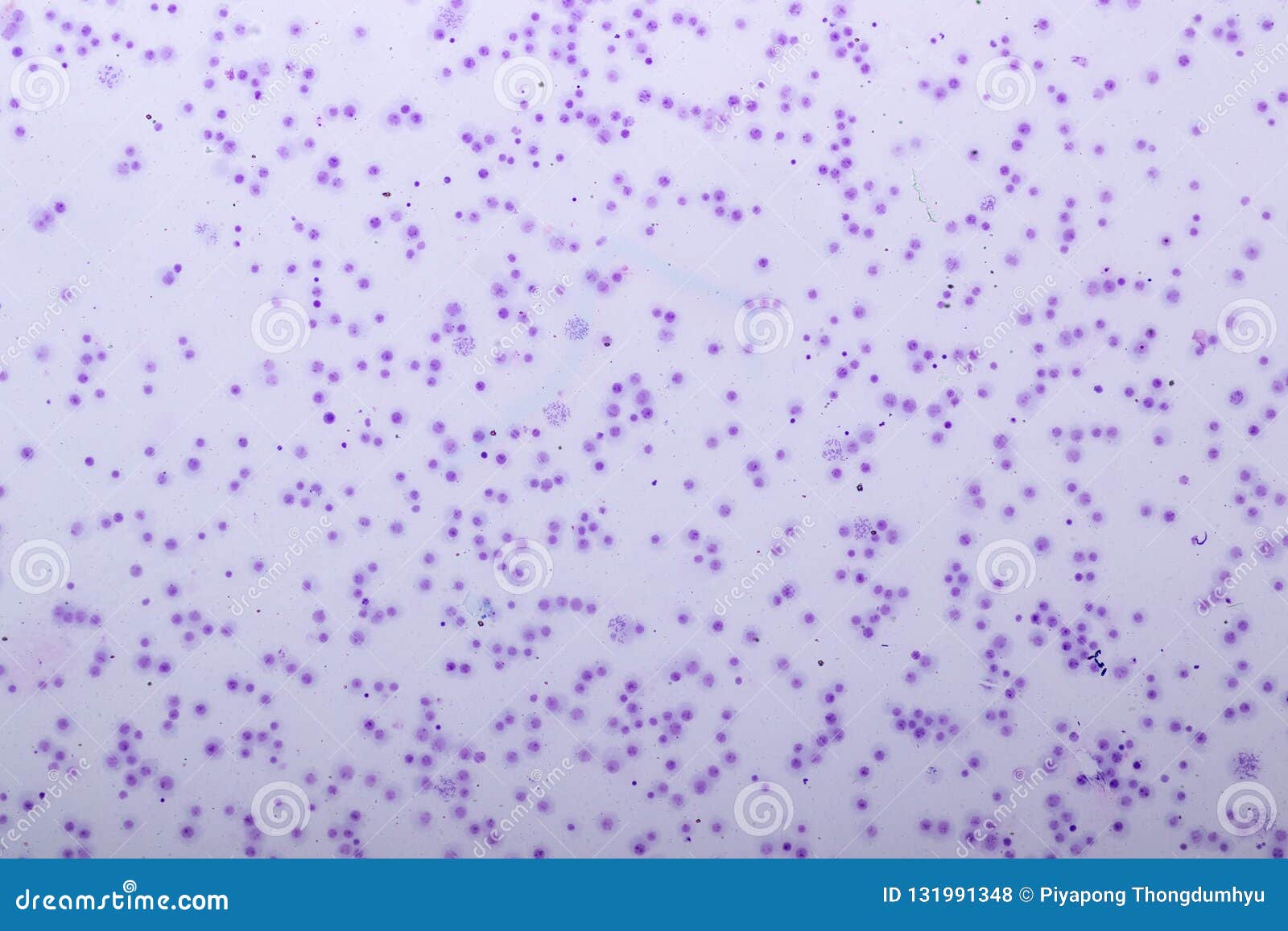 Chromosomes Human Under the Microscope for Education. Stock Photo ...