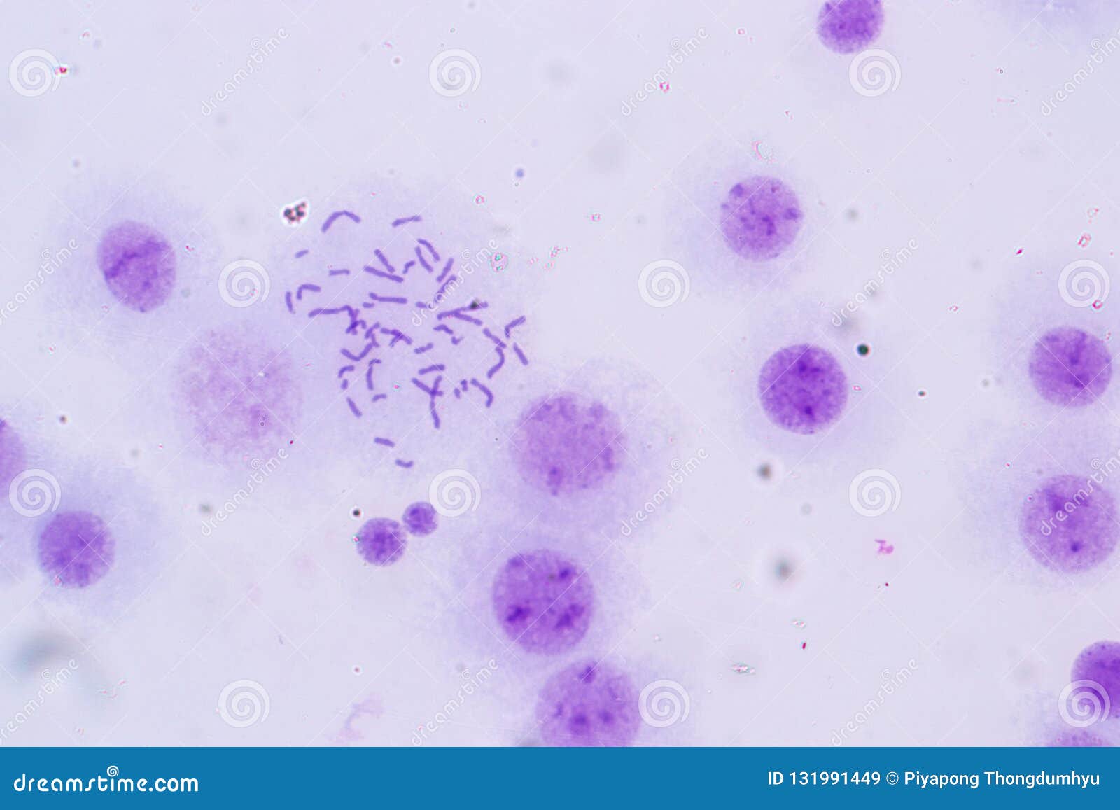 Chromosomes Human Under the Microscope for Education. Stock Image ...