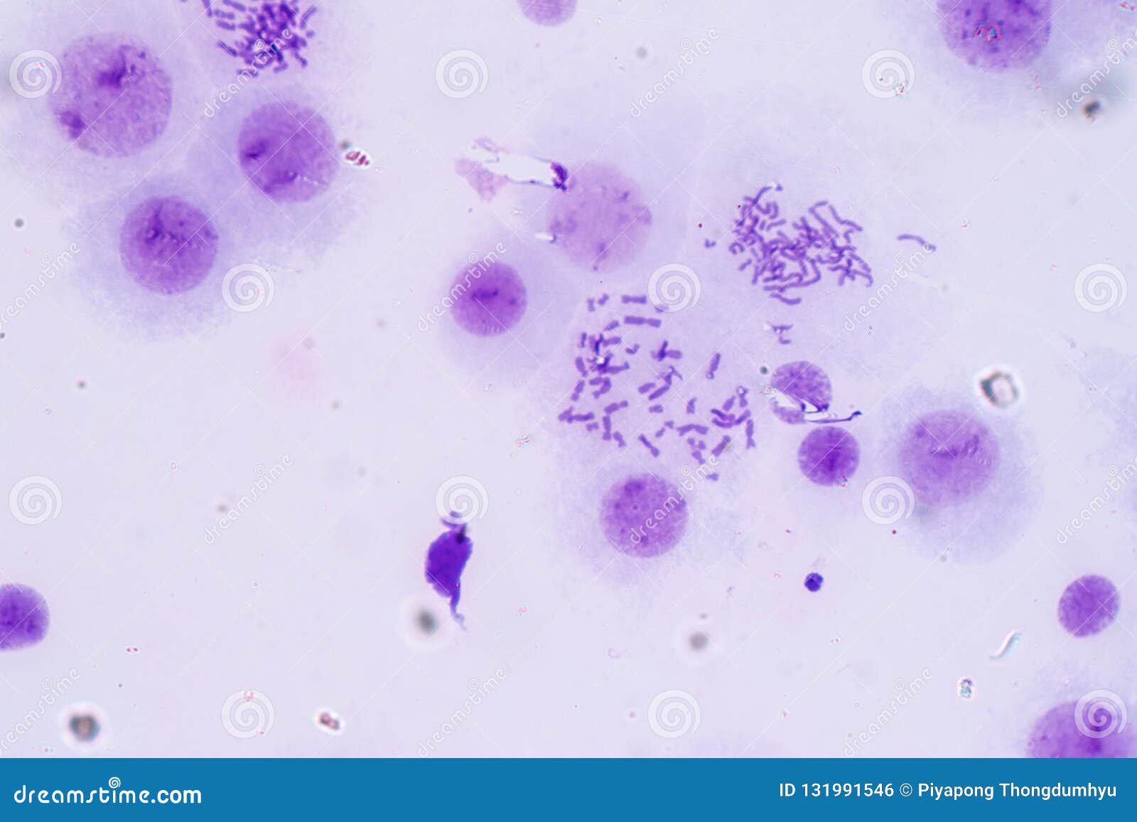 Chromosomes Human Under the Microscope for Education. Stock Photo ...