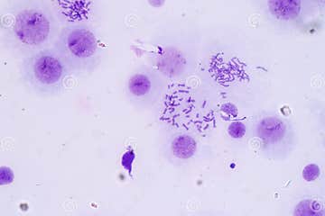 Chromosomes Human Under the Microscope for Education. Stock Photo ...