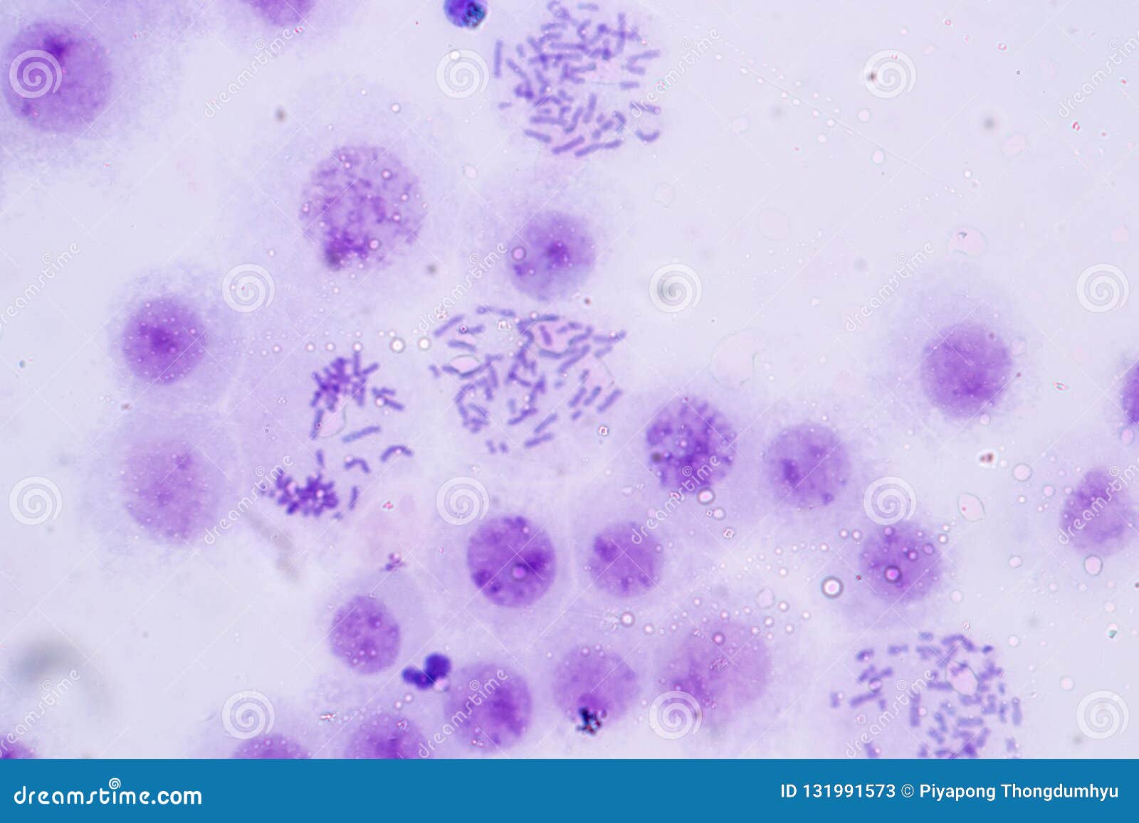 Chromosomes Human Under the Microscope for Education. Stock Image ...