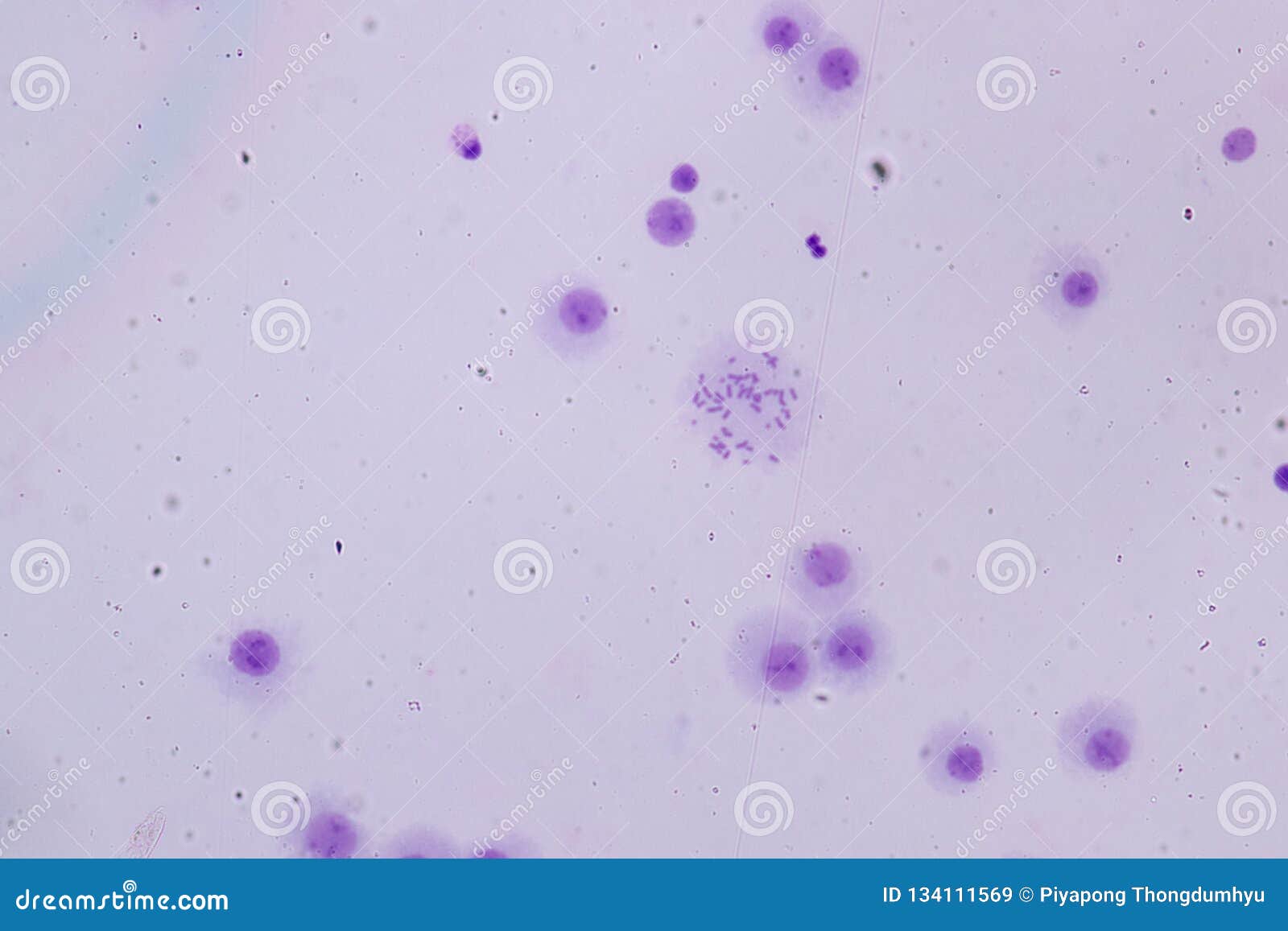 Chromosomes Human Under the Microscope for Education. Stock Image ...