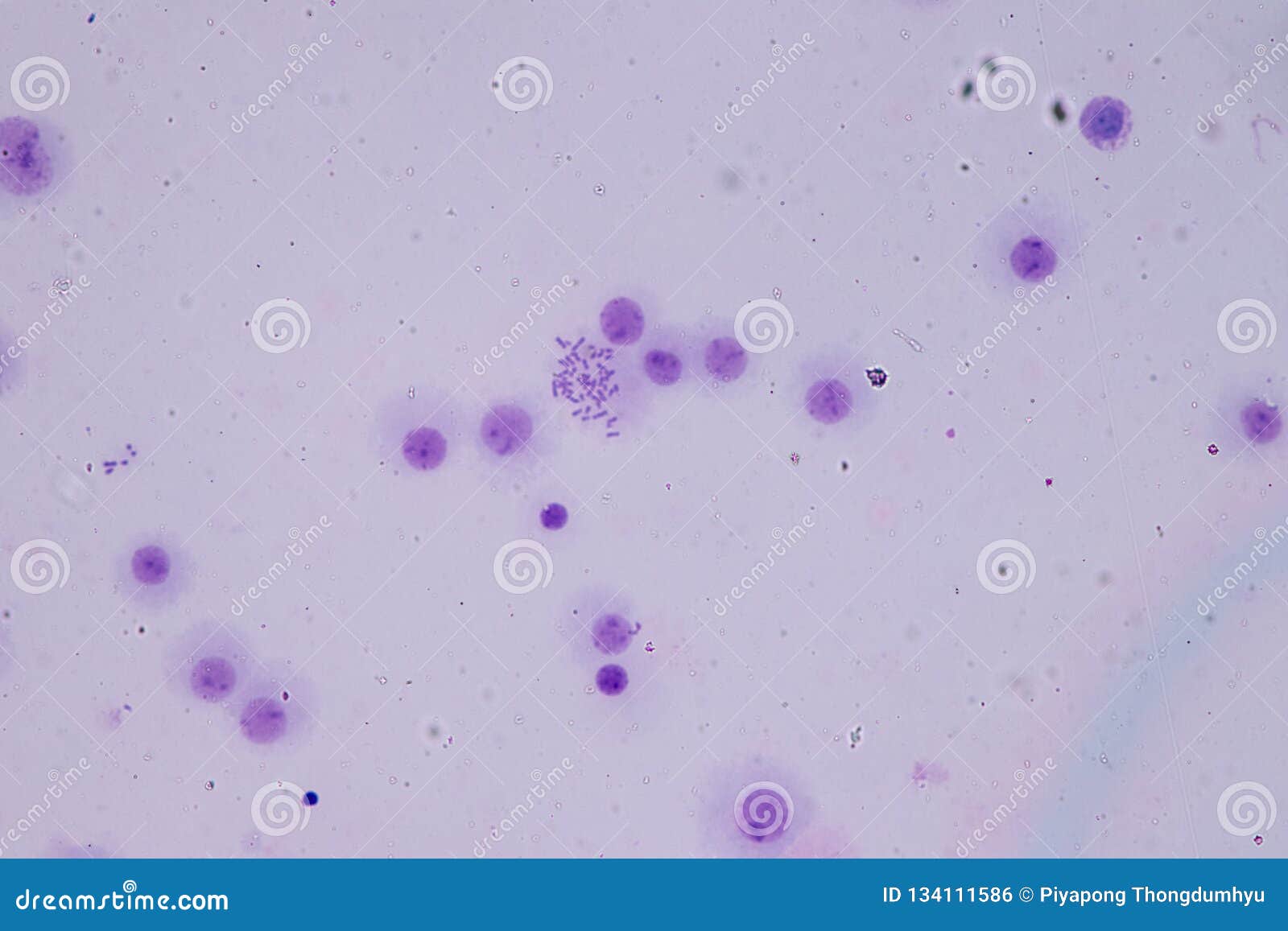 Chromosomes Human Under the Microscope for Education. Stock Photo ...
