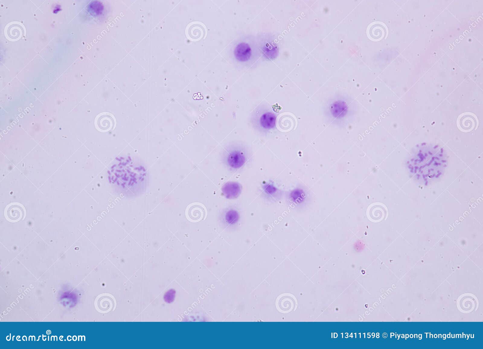 Chromosomes Human Under the Microscope for Education. Stock Photo ...