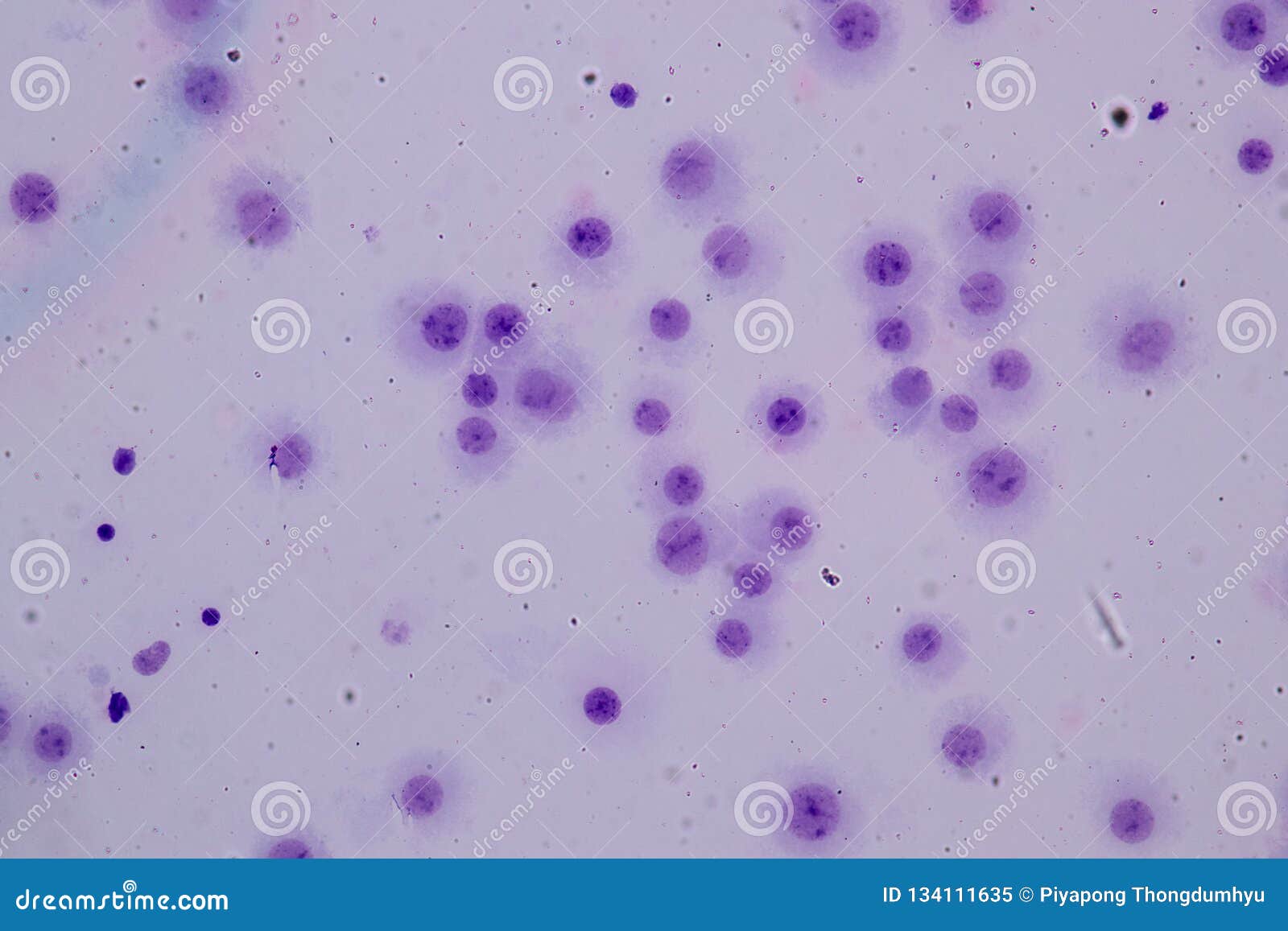 Chromosomes Human Under the Microscope for Education. Stock Image ...