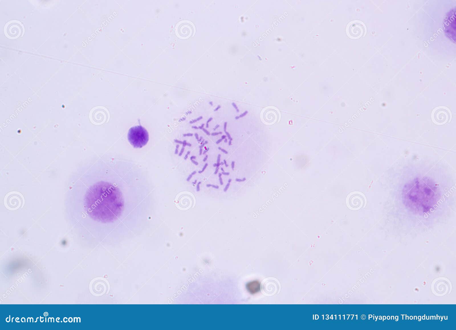Chromosomes Human Under the Microscope for Education. Stock Image ...