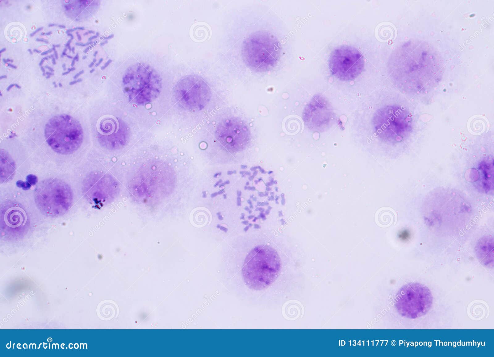 Chromosomes Human Under the Microscope for Education. Stock Image ...