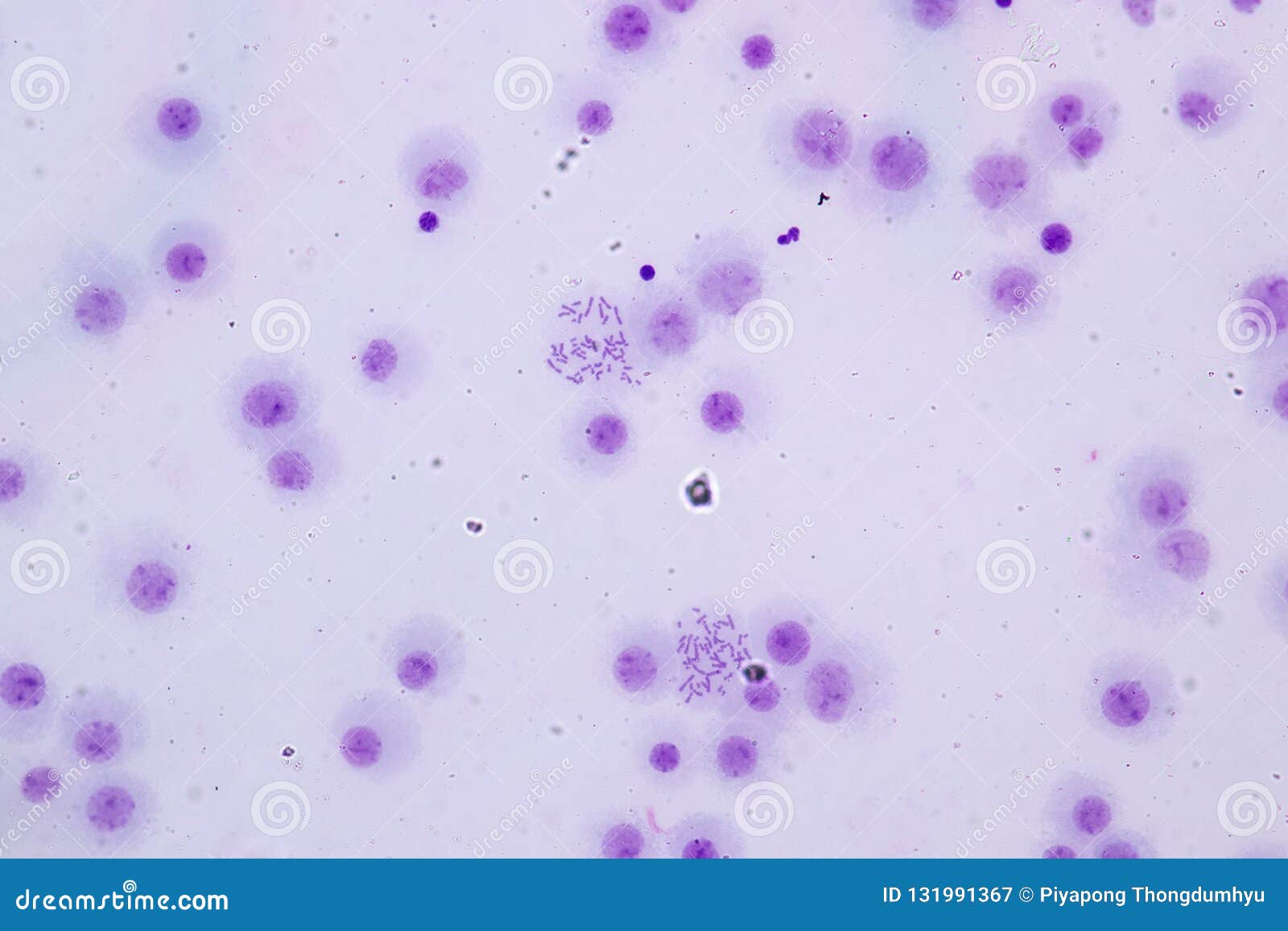 Chromosomes Human Under the Microscope for Education. Stock Image ...