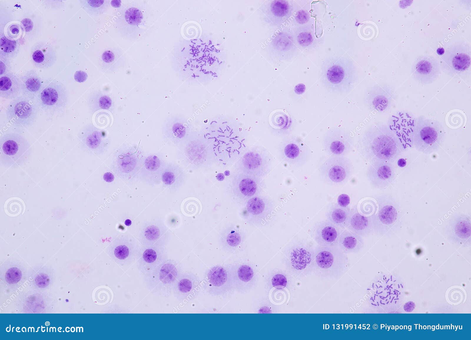 Chromosomes Human Under the Microscope for Education. Stock Photo ...