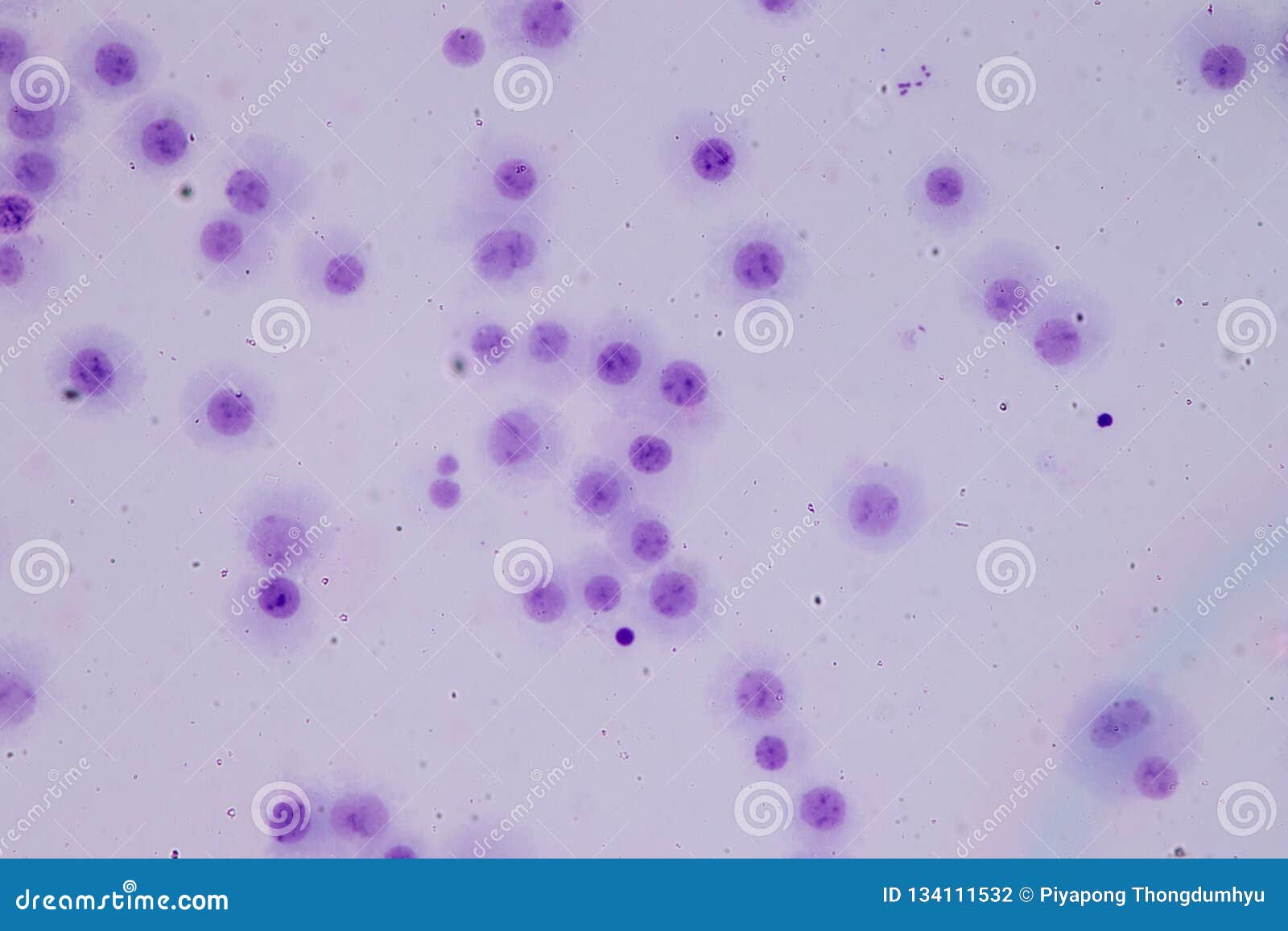 Chromosomes Human Under the Microscope for Education. Stock Photo ...