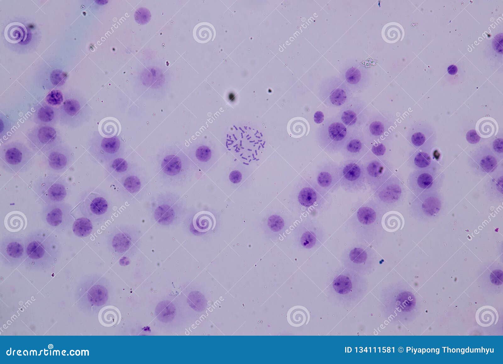 Chromosomes Human Under the Microscope for Education. Stock Image ...