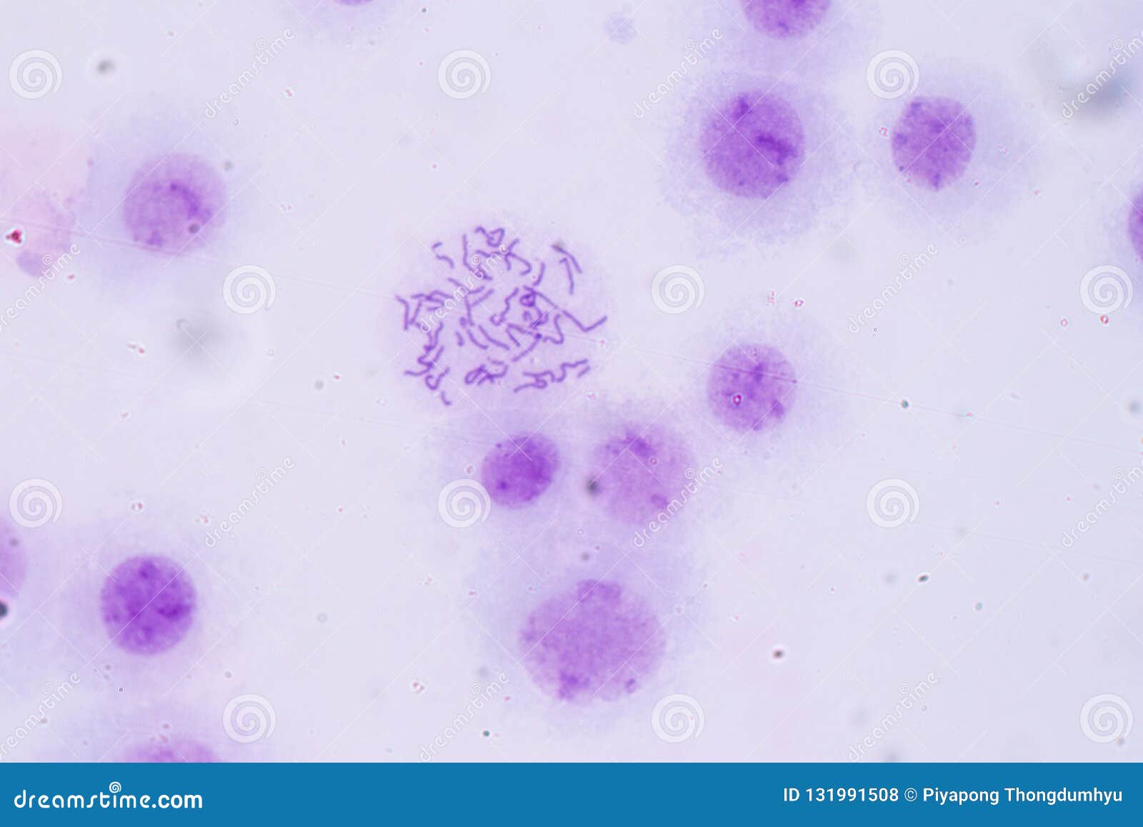Chromosomes Human Under the Microscope for Education. Stock Photo ...