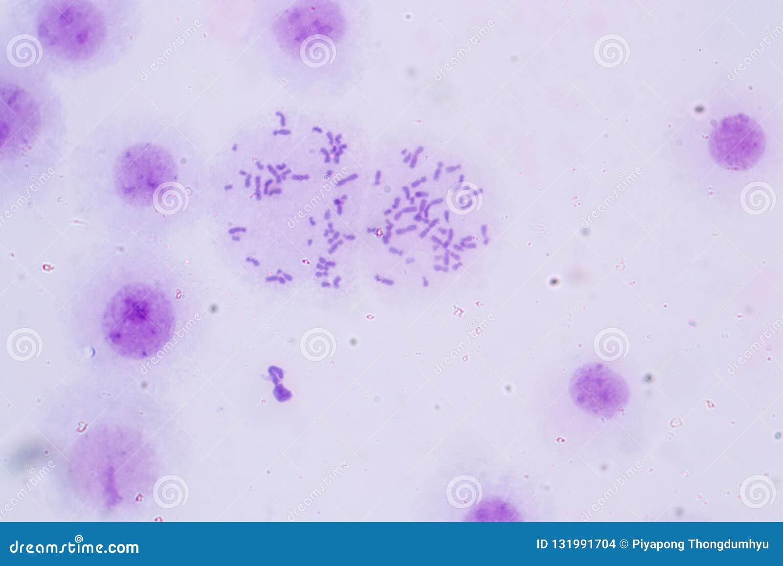 Chromosomes Human Under the Microscope for Education. Stock Photo ...
