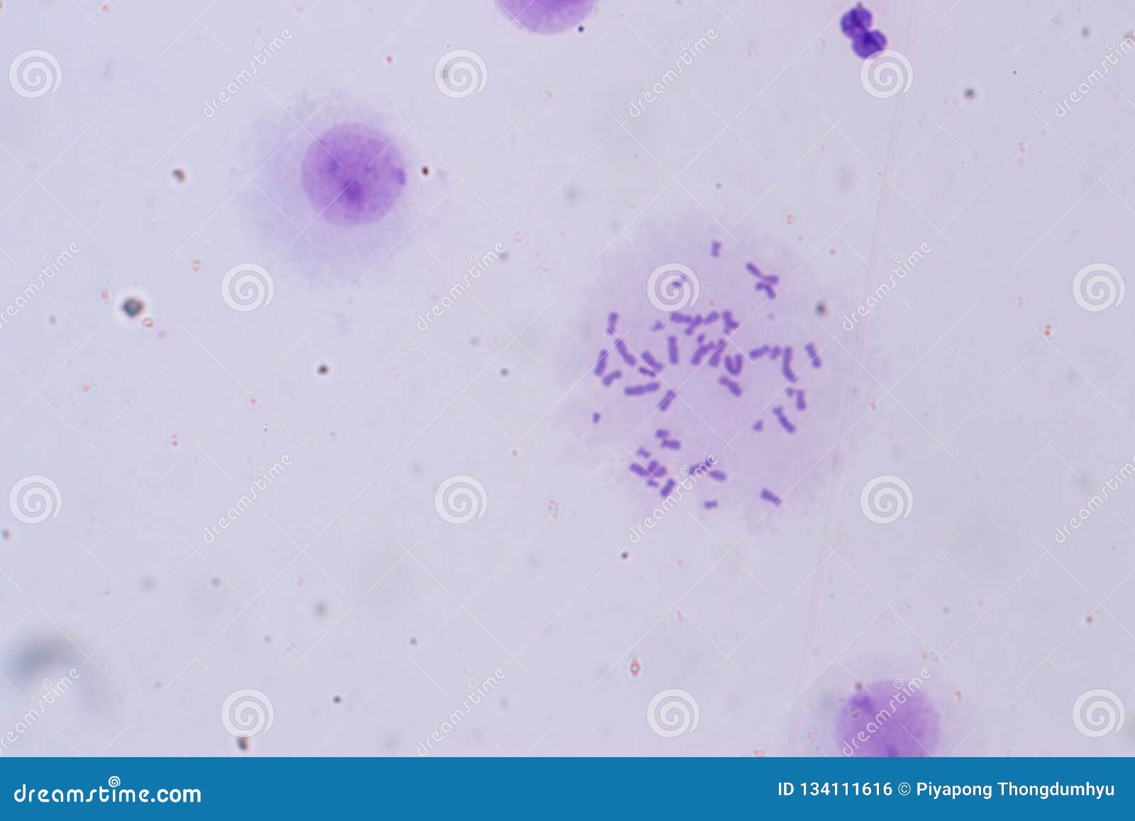 Chromosomes Human Under the Microscope for Education. Stock Photo ...