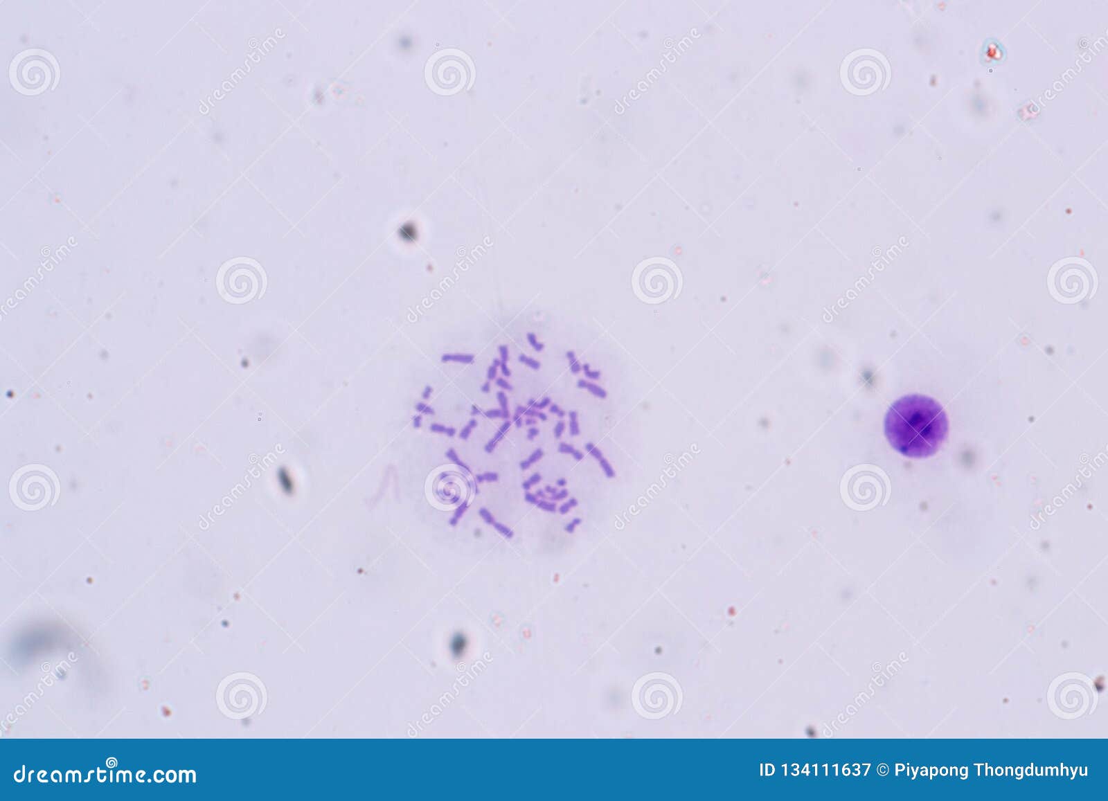 Chromosomes Human Under the Microscope for Education. Stock Image ...