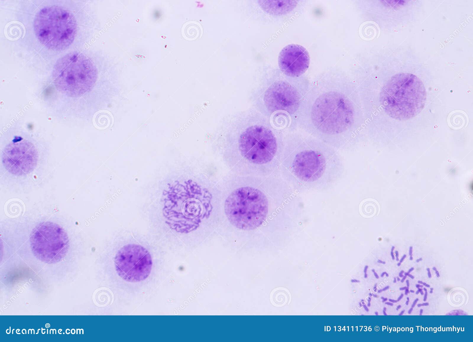 Chromosomes Human Under the Microscope for Education. Stock Photo ...