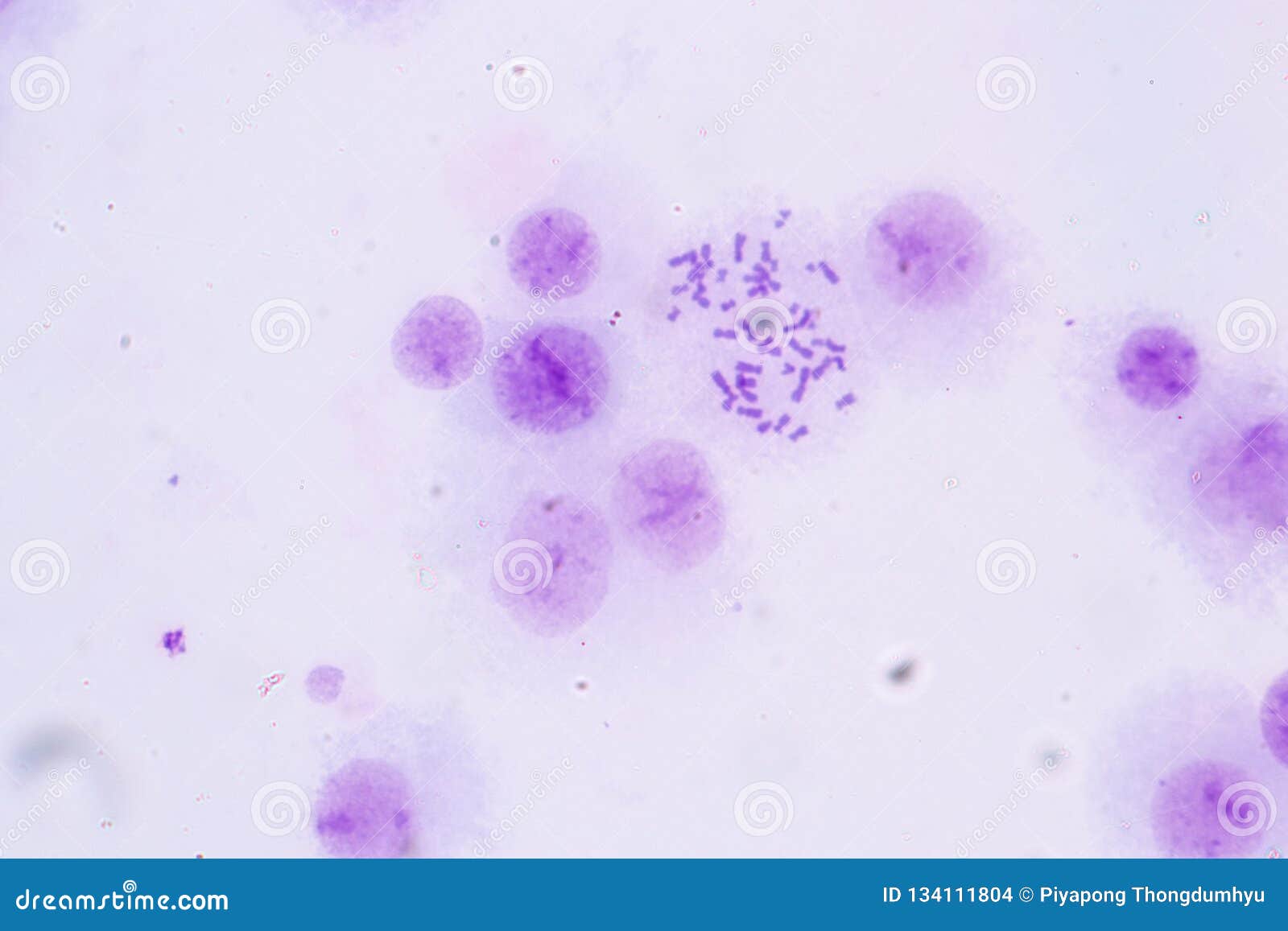 Chromosomes Human Under the Microscope for Education. Stock Photo ...