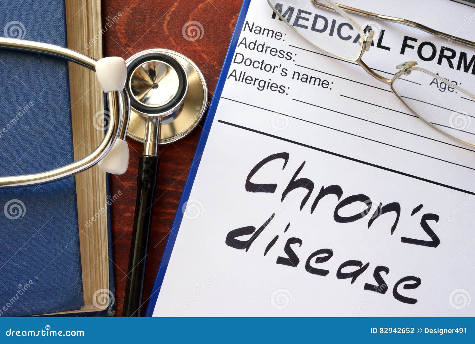 Chron Disease stock photo. Image of digestive, disease - 82942652