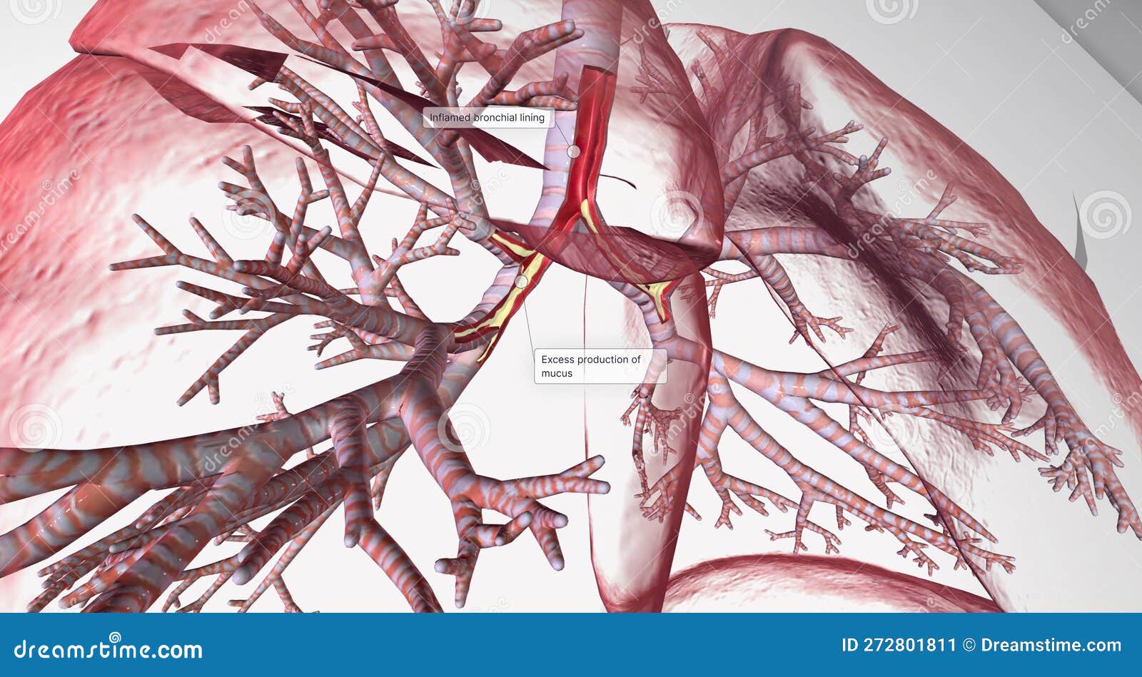 Bronchi Of Lungs Black Silhouette Isolated On White Background. Design ...